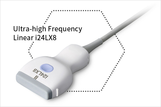 佳能医疗 - 超声